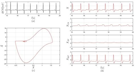 B Presents Simulated Normal Ecg And Each Oscillator Response That Download Scientific Diagram