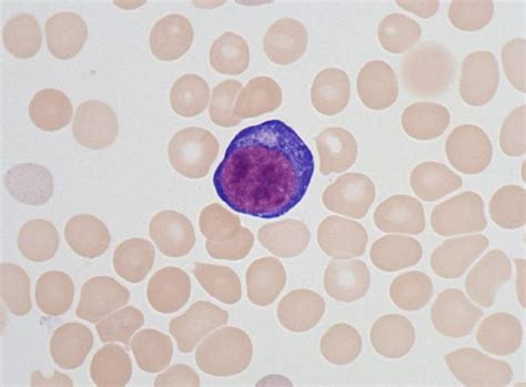 Proerythroblast Horiba