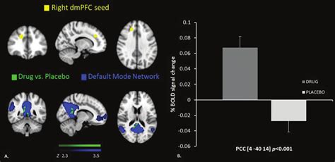 A Resting State Functional Connectivity Rsfc Between The Right Download Scientific Diagram