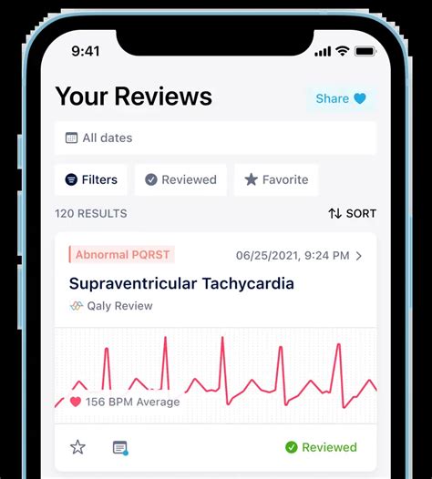 What Premature Ventricular Contraction Pvc Looks Like On Your Watch