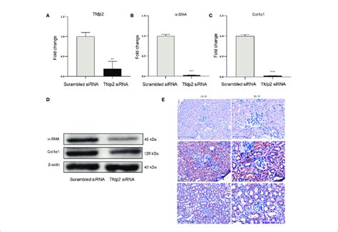 Overexpression Of Tfdp2 In Cisplatin Induced Renal Fibrosis A The