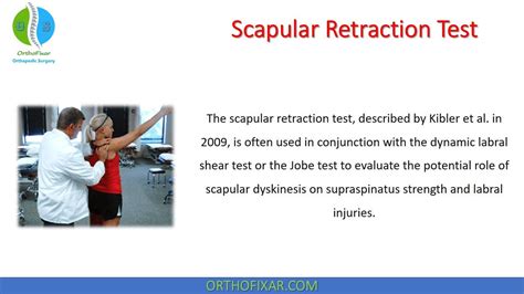 Scapular Retraction Test Rorthofixar