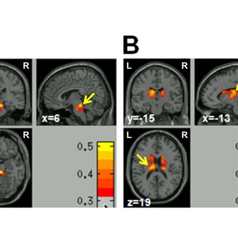 Resting State Functional Connectivity Fc Analysis Results A