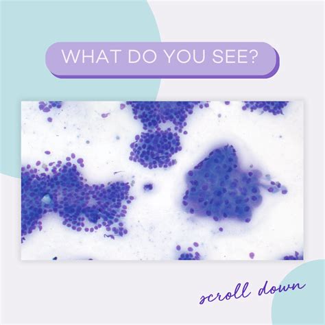 A Tale Of Two Epithelial Cells