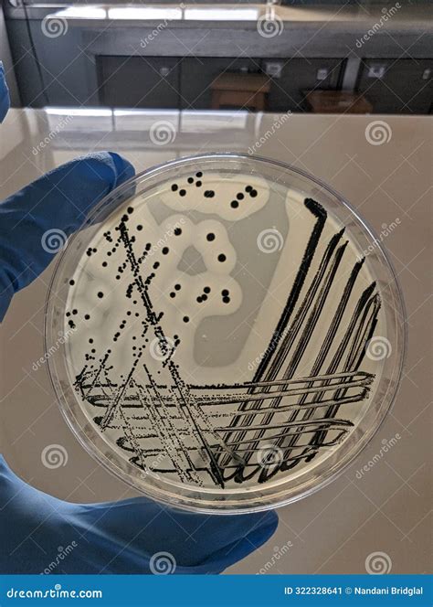 Staphylococcus Aureus Oxacillin Agar Third Check Plate Editorial Photo