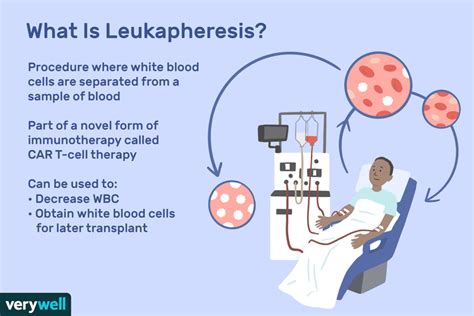 Leukapheresis Uses Side Effects Procedure Results
