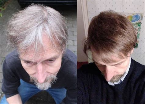 Grey Hair Treatment Gr 7 Professional