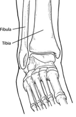 Ankle Fractures Foot And Ankle Specialists Of Middle Tennessee