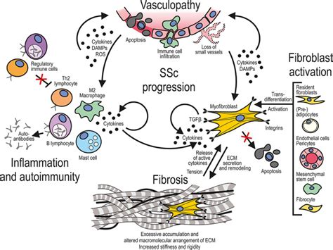 Pathophysiology Of Systemic Sclerosis Scleroderma Pmc