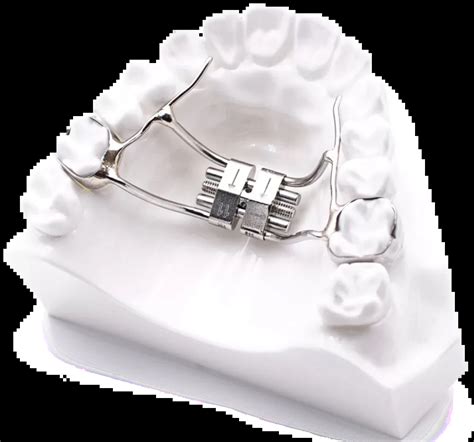 Appareils Fonctionnels Orthodontie Docteur Ohayon Strasbourg