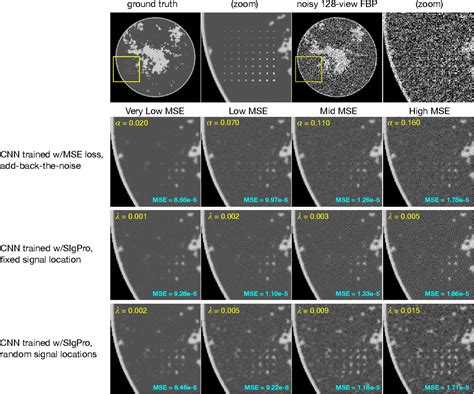 Figure 7 From Enhancing Signal Detectability In Learning Based Ct Reconstruction With A Model