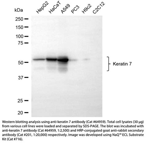 Kd Validated Anti Keratin 7 Rabbit Pab 64959 Genuin Biotech