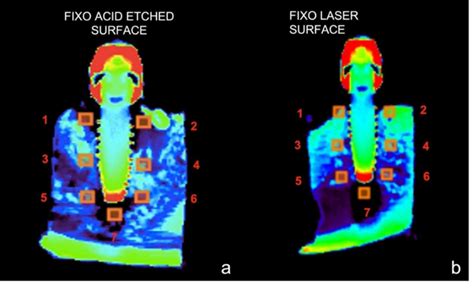 Technical Of Different Steps Followed For The Acquisition And Download Scientific Diagram