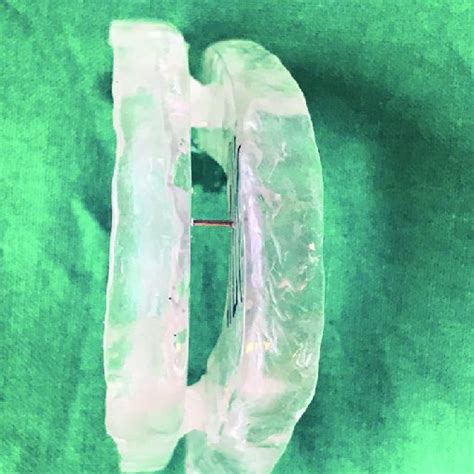 Mandibular Advancement Splint Download Scientific Diagram
