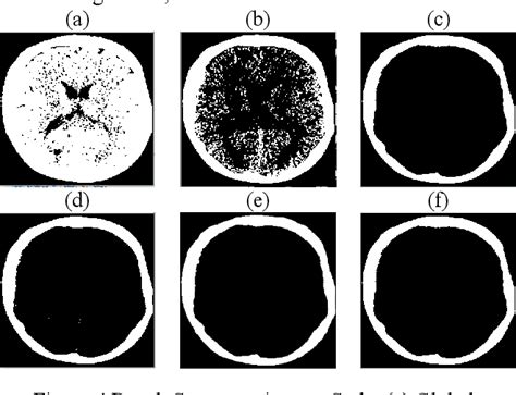 Figure 2 From Segmentation Stroke Objects Based On Ct Scan Image Using