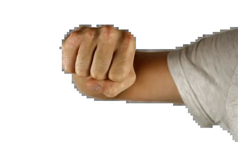 Непознат нападна и счупи челюстта на жена в София ᐉ Новини Tribune Bg