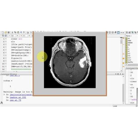 fuzzy c means clustering for image segmentation in matlab techpacs canada limited