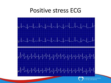 Ppt Comprehensive Guide To Cardiovascular Imaging Techniques And