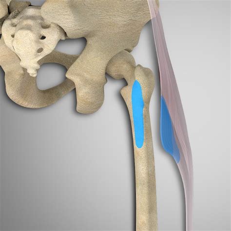 Insertion Of Gluteus Maximus 3d Muscle Lab