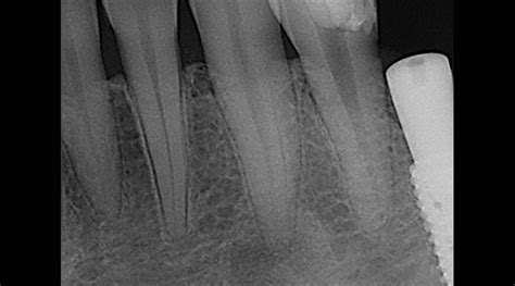 채움과이음치과