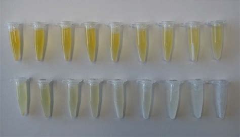 Figure 1 From Investigation Of Tio2 And Invo4 Tio2 Semiconductors For The Photocatalytic