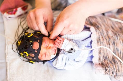 Neurological Monitoring Of The High Risk Infant Eeg And Aeeg Escnh European Standards Of