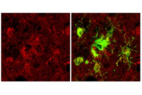 Picalm Signaling Antibody Sampler Kit Cell Signaling Technology