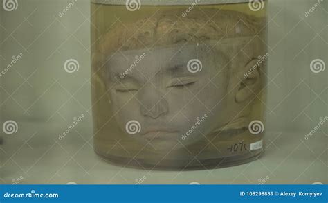 Anatomical Human Specimens In Formalin Editorial Stock Image Image Of