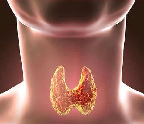 Thyroid Tincture Kingdom Come Home