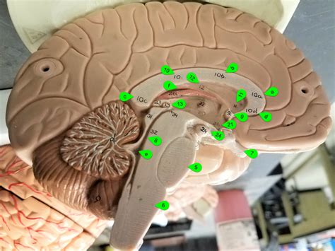 Sagittal Brain Diagram Quizlet