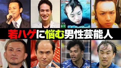 若ハゲに悩む芸能人有名人26選 YouTube