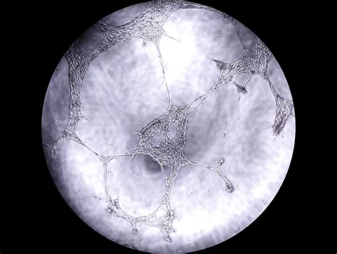 Angiogenesis Analyzer Not Working Image Analysis Imagesc Forum