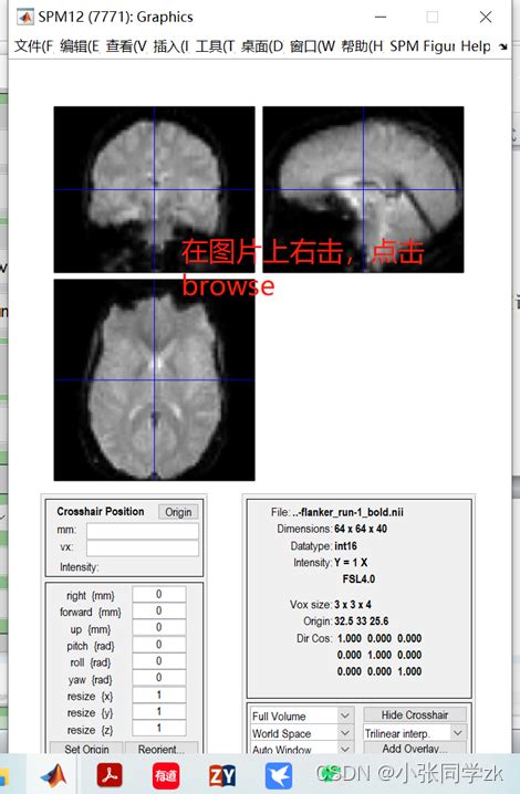 基于spm12对fmri数据的分析（超详细） spm12实验 csdn博客