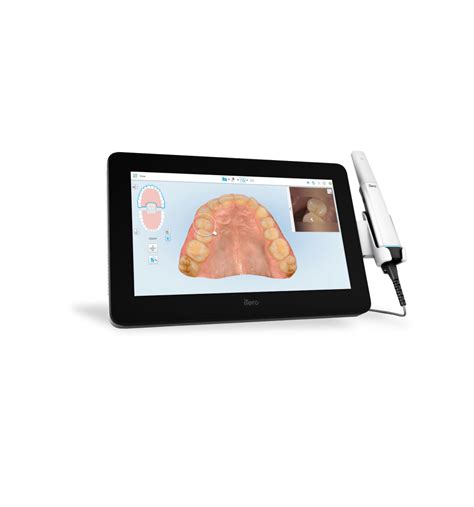 Intraoral Scanners Itero