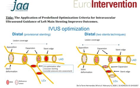 The Application Of Predefined Optimisation Criteria For Intravascular