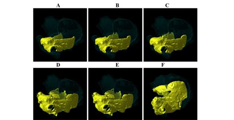 Initiation And Propagation Of Scroll Wave In Human Female Atrium Download Scientific Diagram