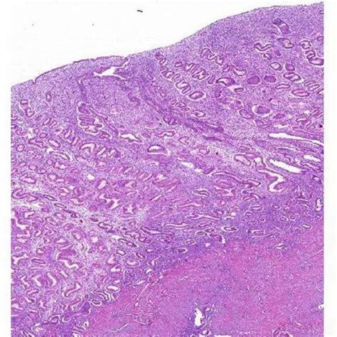 Endometrium Histology Slides Brain Waves Pathology