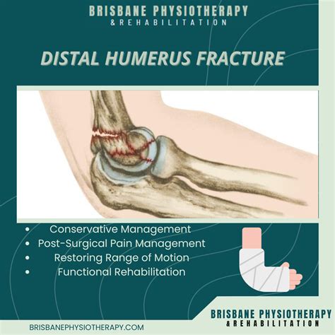 Distal Humerus Fracture Recovery And Rehabilitation Brisbane Physiotherapy And Podiatry