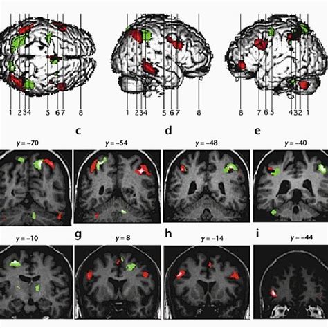 Areas For Auditory And Visual Spatial Localizationstatistical