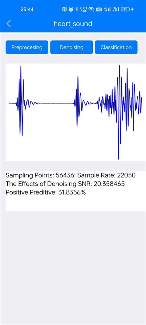 Screenshot Of Heart Sounds Classification In A Mobile Phone Download Scientific Diagram