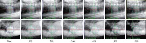 Comparing Pixel Density Differences Among Real Time X Ray Images Of A Download Scientific
