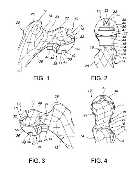 Proximal Femur Patented Technology Retrieval Search Results Eureka Patsnap
