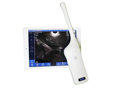 Portable Ultrasound WiFi Ultrasound Buy Wireless Ultrasound Probe Transvaginal MHz For