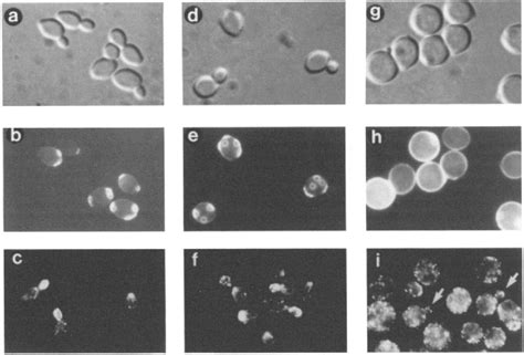 Figure 1 From Control Of Cellular Morphogenesis By The Ip12bem2 Gtpase