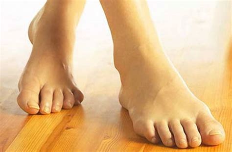 პოდაგრა Tsamali Ge