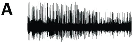Figure A1 Raw Traces From Microelectrode Recordings Mer From