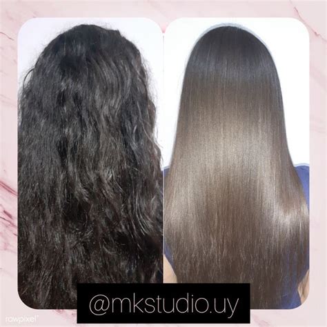 Cirugía Capilar Tratamientos Para El Cabello Cabello Cirugia Plástica