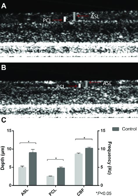 Hypoxia Reduces Asl Pcl And Cbf When Measured By Micro Optical