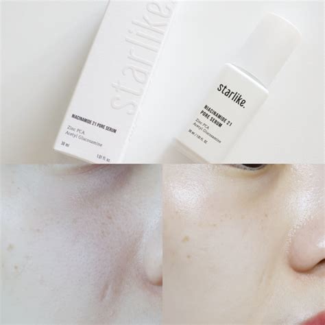 스타라이크 나이아신아마이드 세럼 전후 차이나는 모공앰플 내돈내산 후기 네이버 블로그