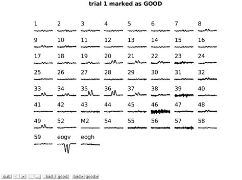 Getting Started With Eeg Data Quality Checks And Erps Fieldtrip Toolbox
